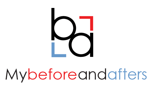 Create an Account – My Before & Afters